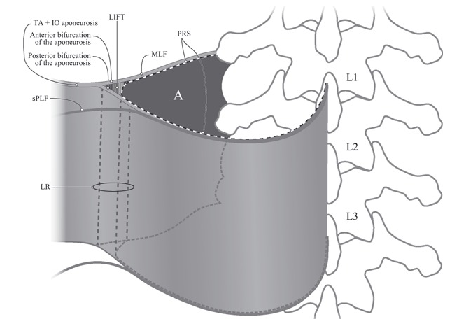 Article — The Functional Coupling of the Deep Abdominal and Paraspinal ...